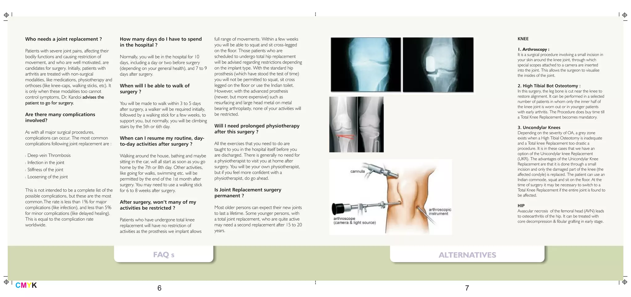 IACP Arthritis clinic Arthroplasty brochure | PDF