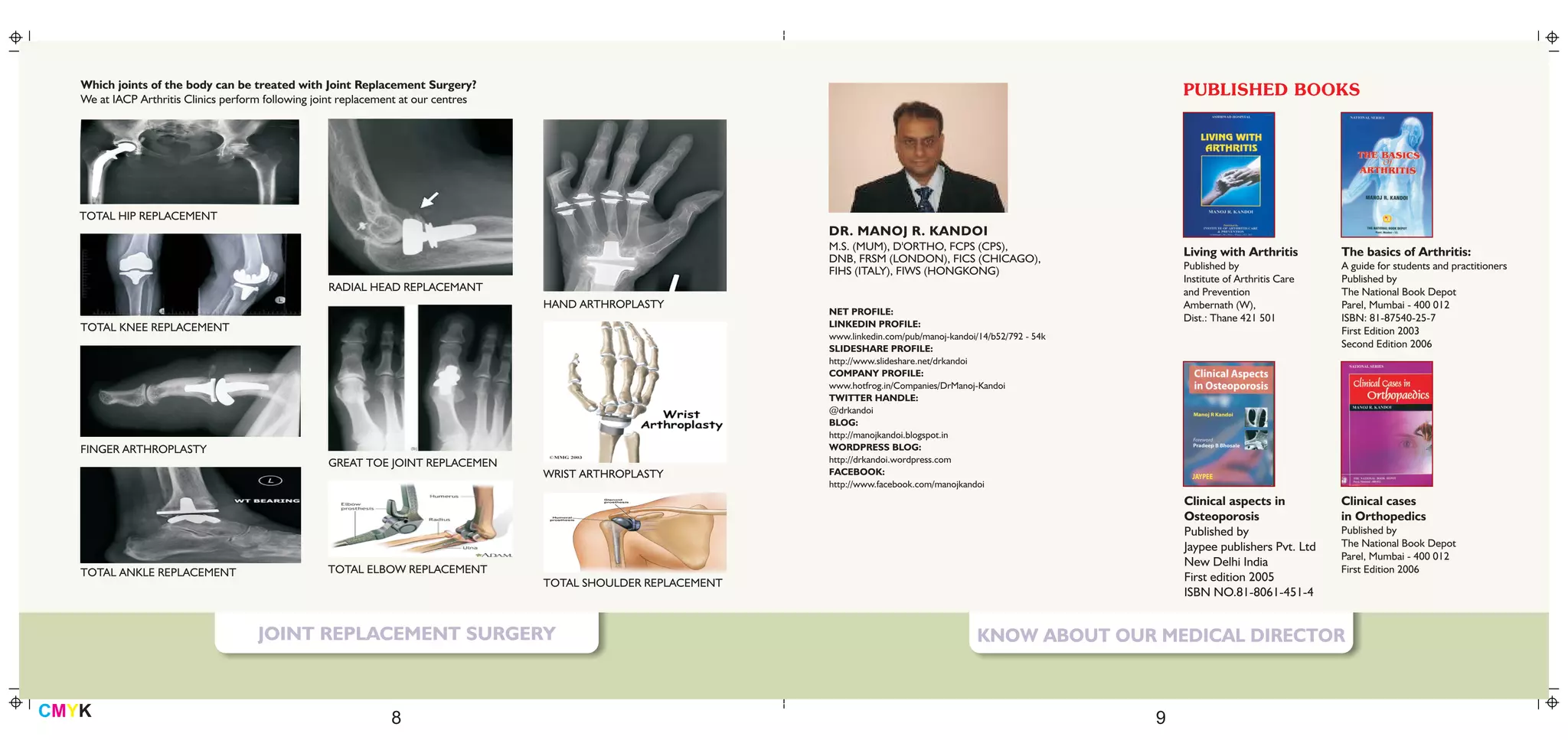 IACP Arthritis clinic Arthroplasty brochure | PDF