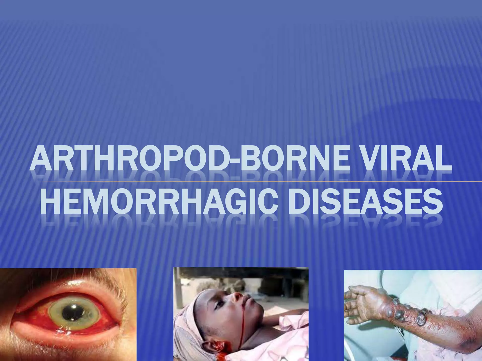 Arthropod-born infections | PPTX