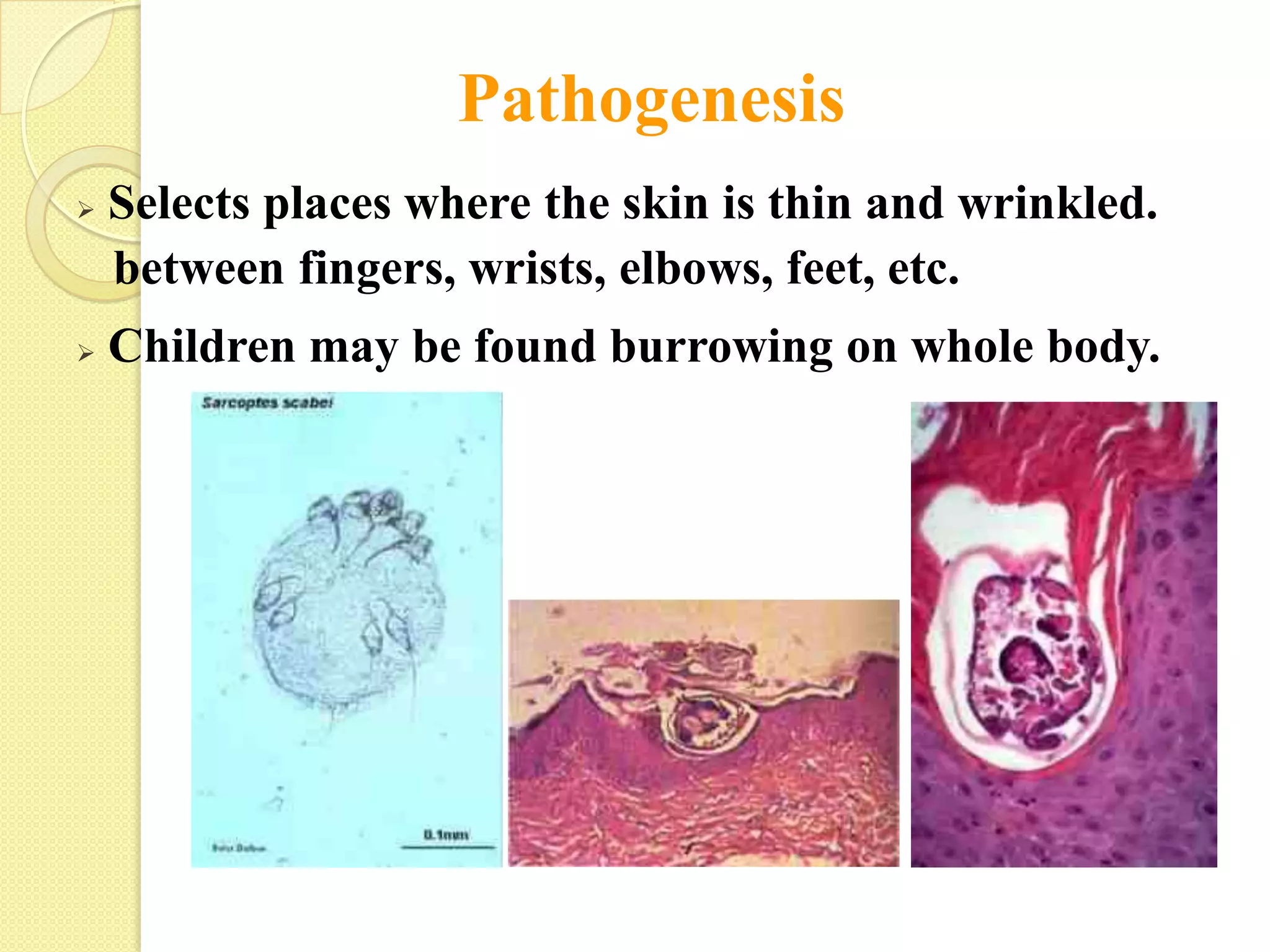 Arthropods | PPT