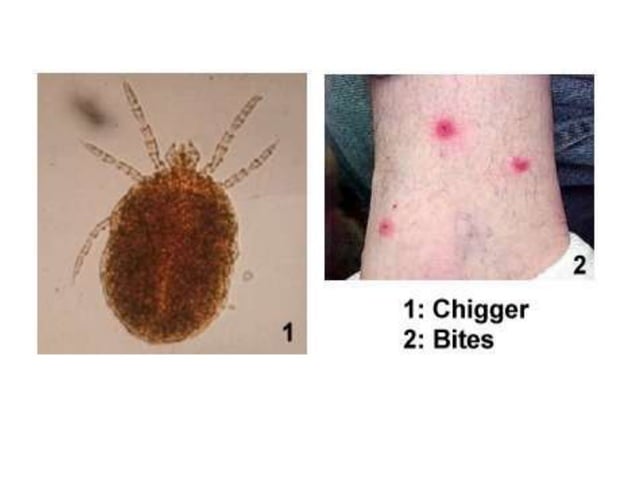 Arthropods mites | PPT