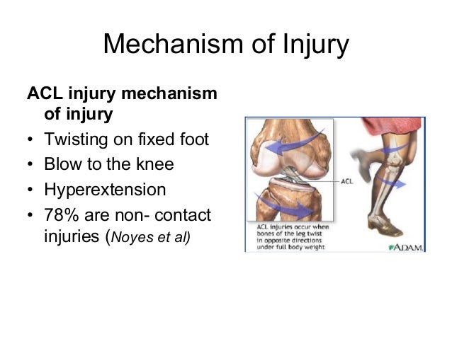 Arthroscopic ACL Reconstruction By Dr Shekhar Shrivastav