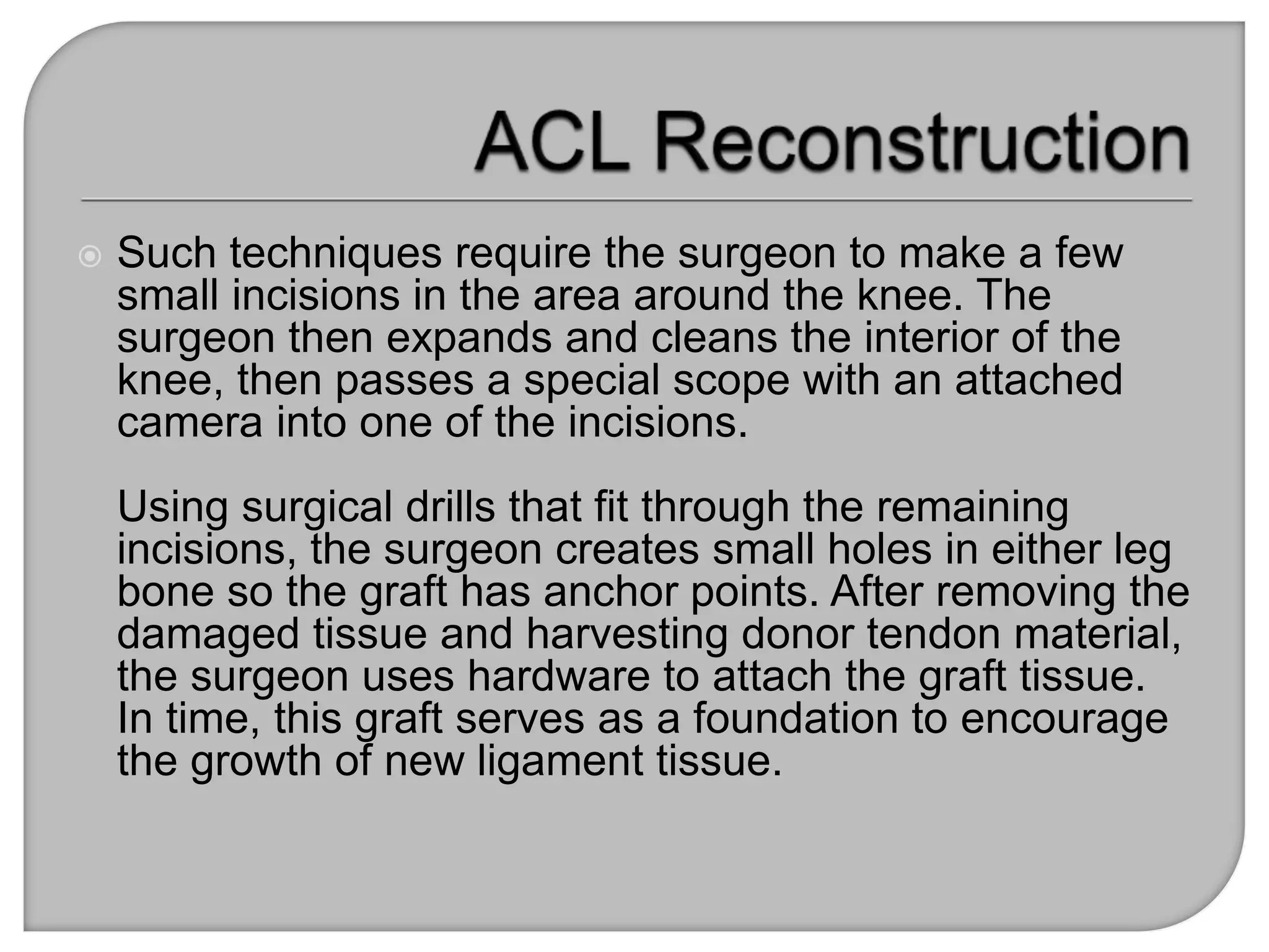 Arthroscopic ACL Reconstruction | PPTX