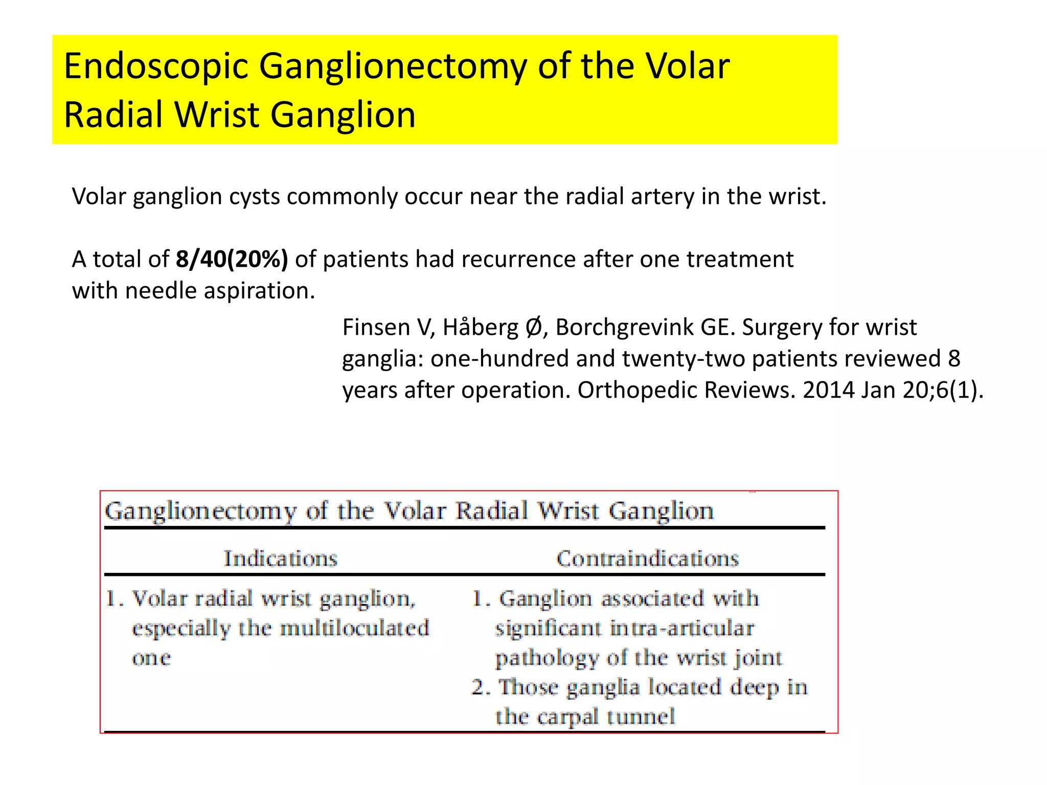 Arthroscopic excision of gnglion cyst | PPT