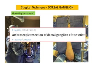 Arthroscopic excision of gnglion cyst | PPT