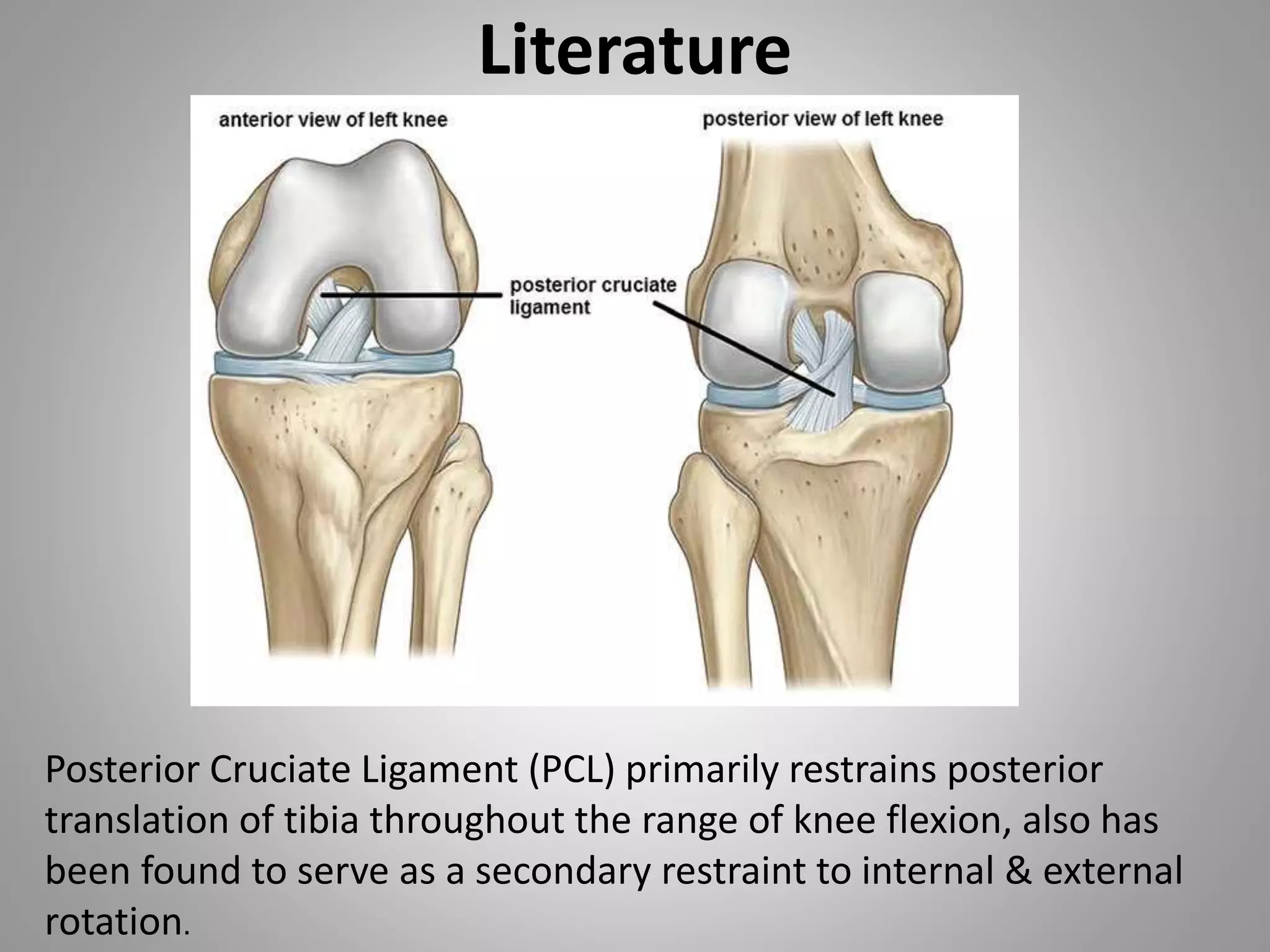 Arthroscopic pcl reconstruction | PPTX