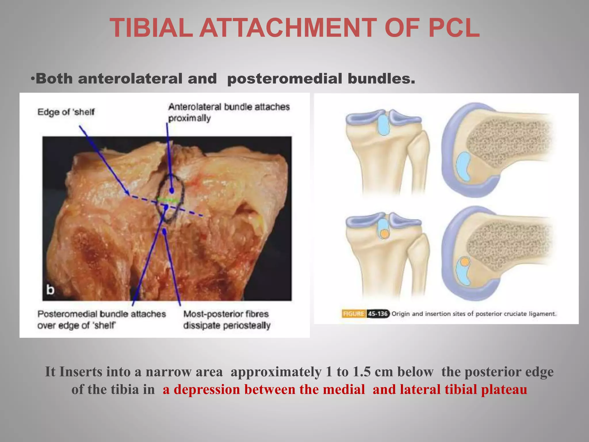 Arthroscopic pcl reconstruction | PPTX