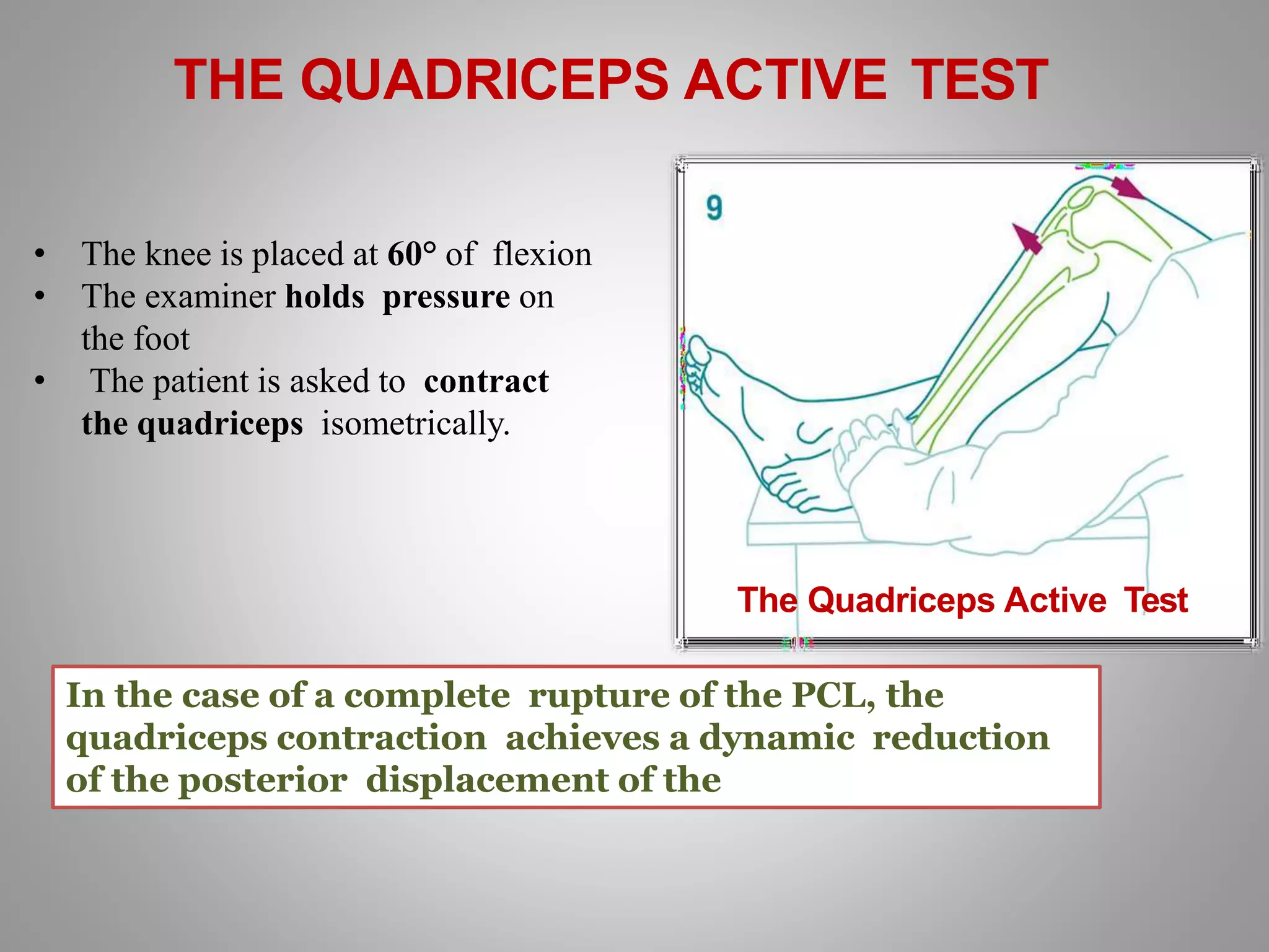 Arthroscopic pcl reconstruction | PPTX