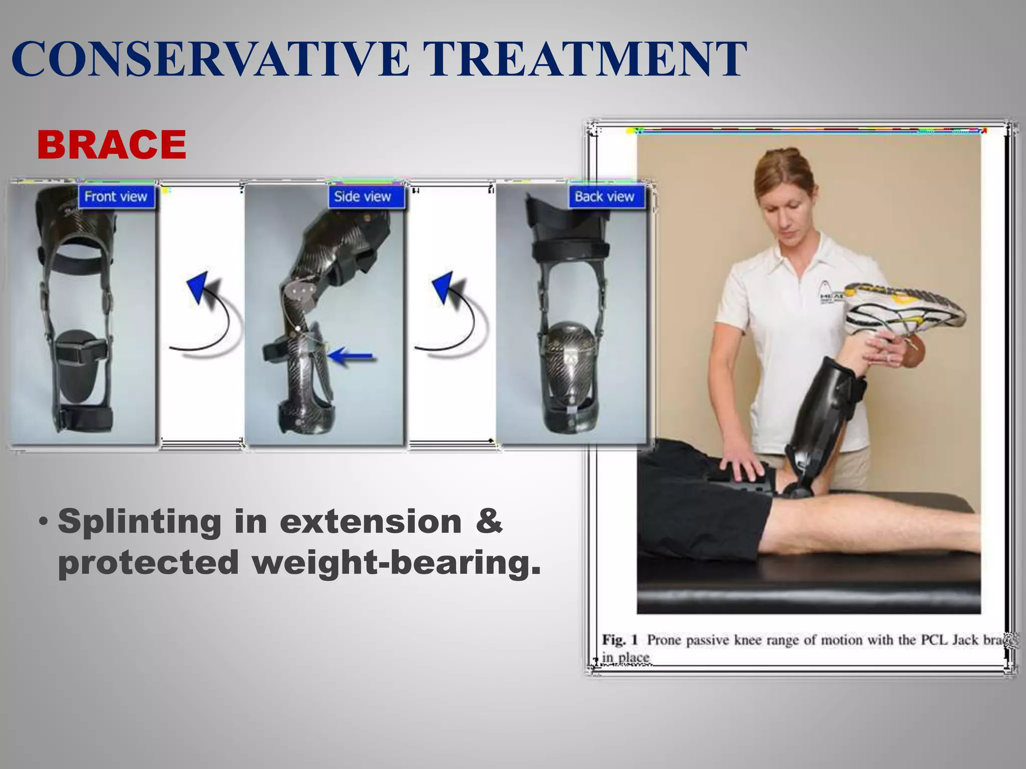 Arthroscopic pcl reconstruction | PPTX
