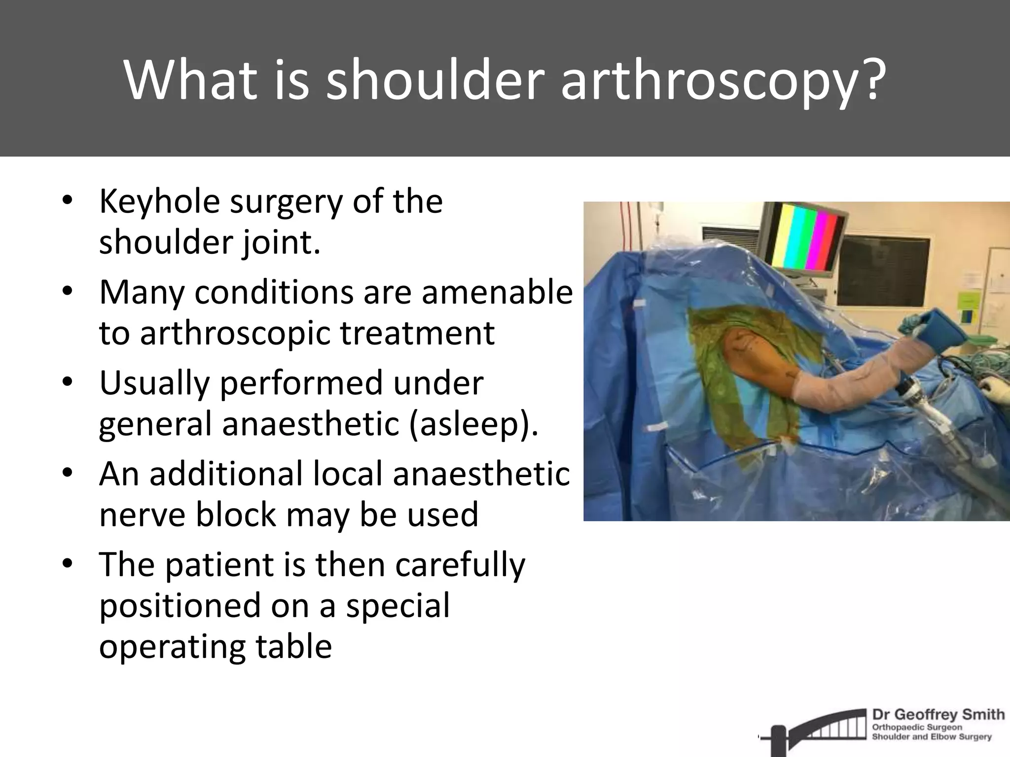 Arthroscopic shoulder stabilisation patient information | PPT
