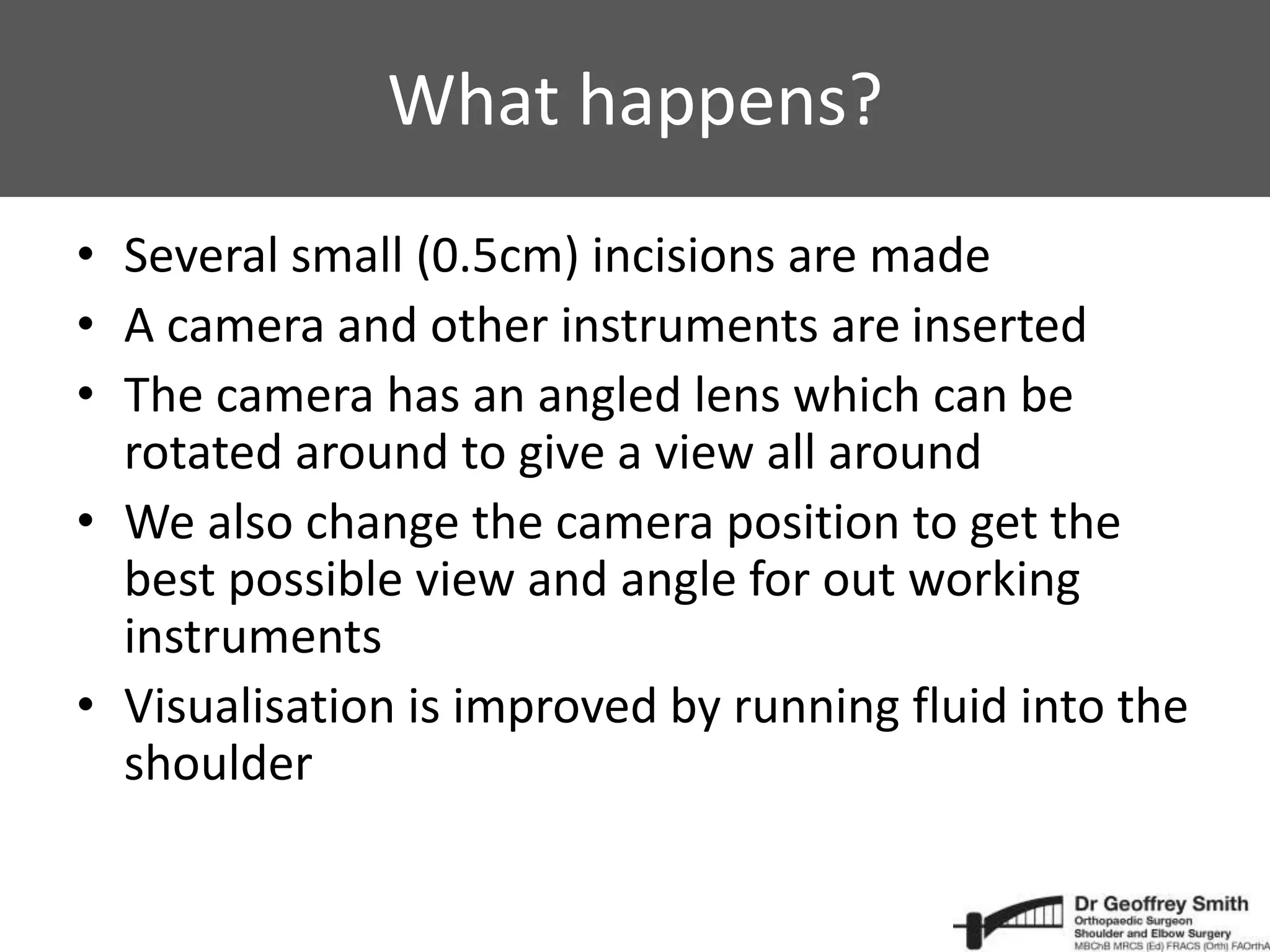 Arthroscopic shoulder stabilisation patient information | PPTX