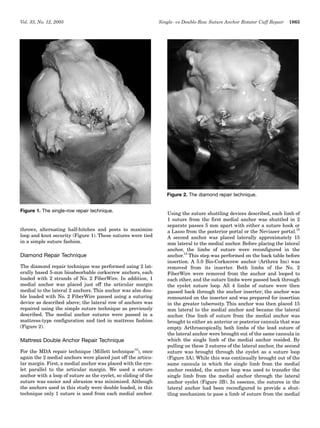 Arthroscopic Single Row Versus Double-Row Suture Anchor Rotator Cuff Repair | Peter J. Millett ...