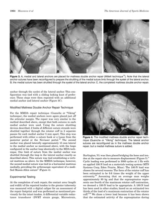 Arthroscopic Single Row Versus Double-Row Suture Anchor Rotator Cuff ...