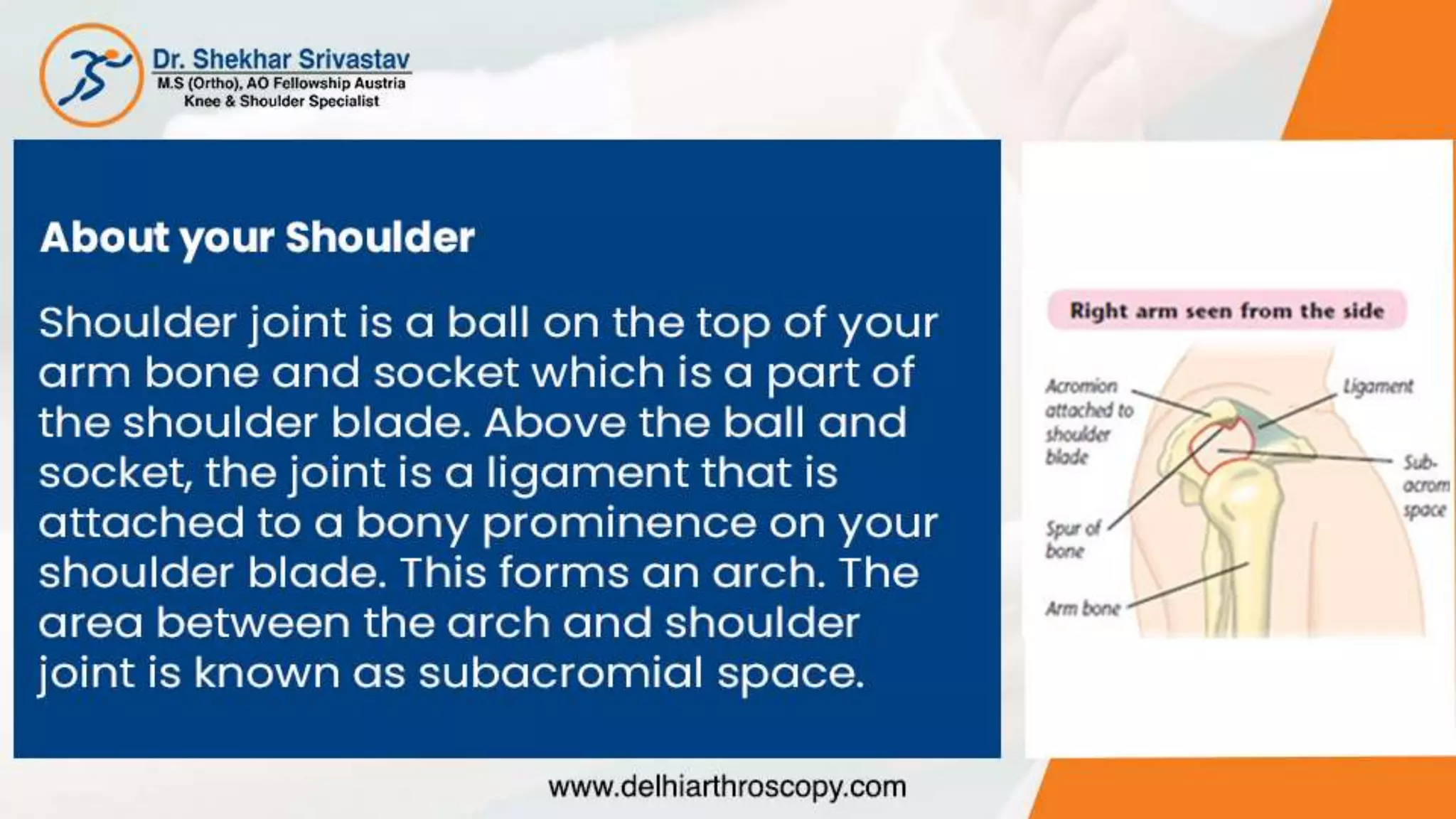 Arthroscopic Subacromial Decompression { Best Shoulder Arthroscopy ...