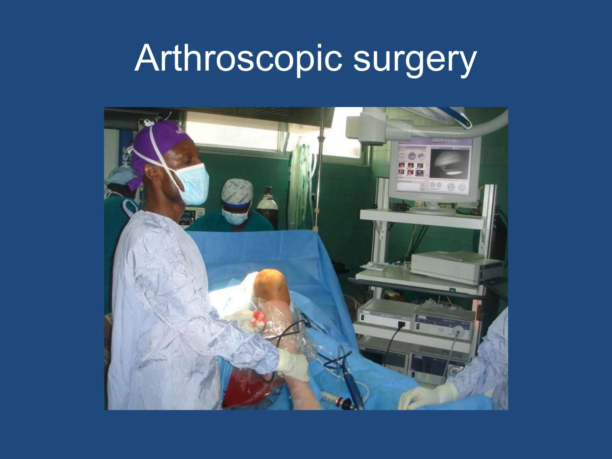 Arthroscopic Surgery.pptx