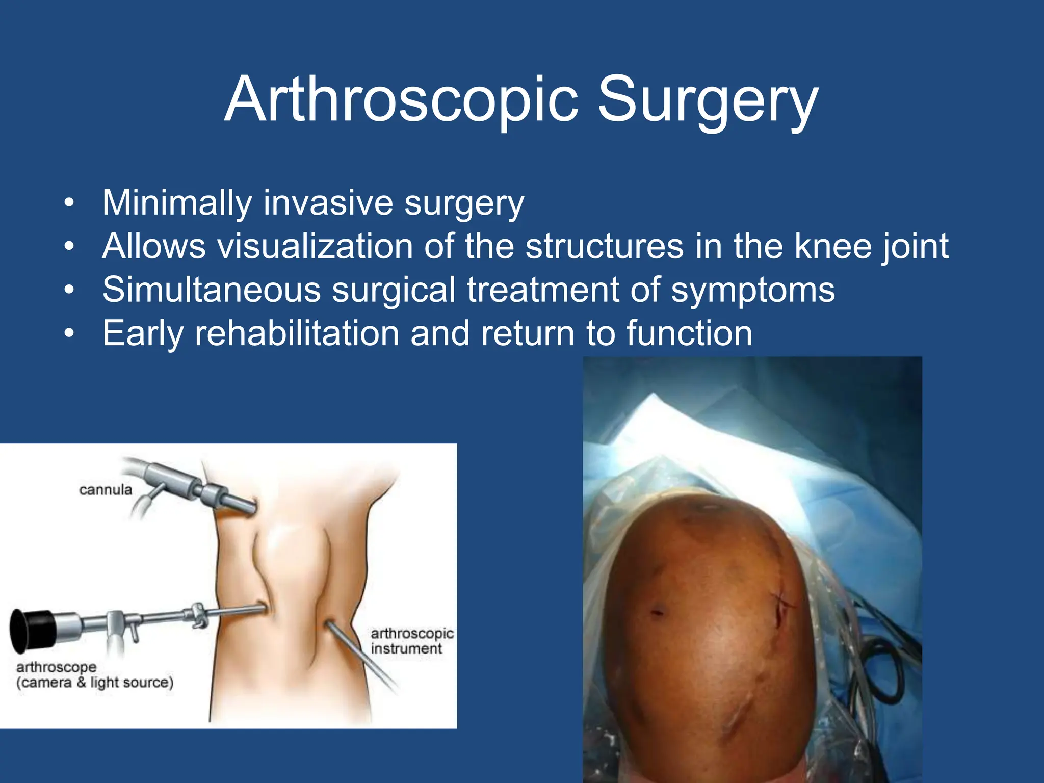 Arthroscopic Surgery.pptx