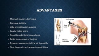 Arthroscopic surgery - Introduction, indications, advantages and procedure. | PPTX