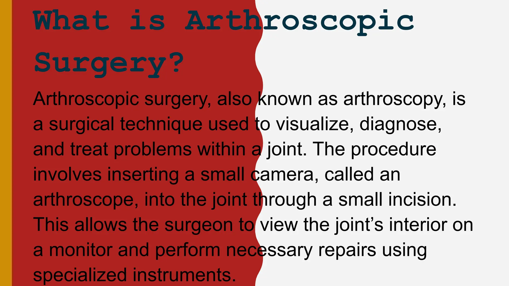 Arthroscopic Surgery in Indore : A Minimally Invasive Guide to Joint Health | PPTX