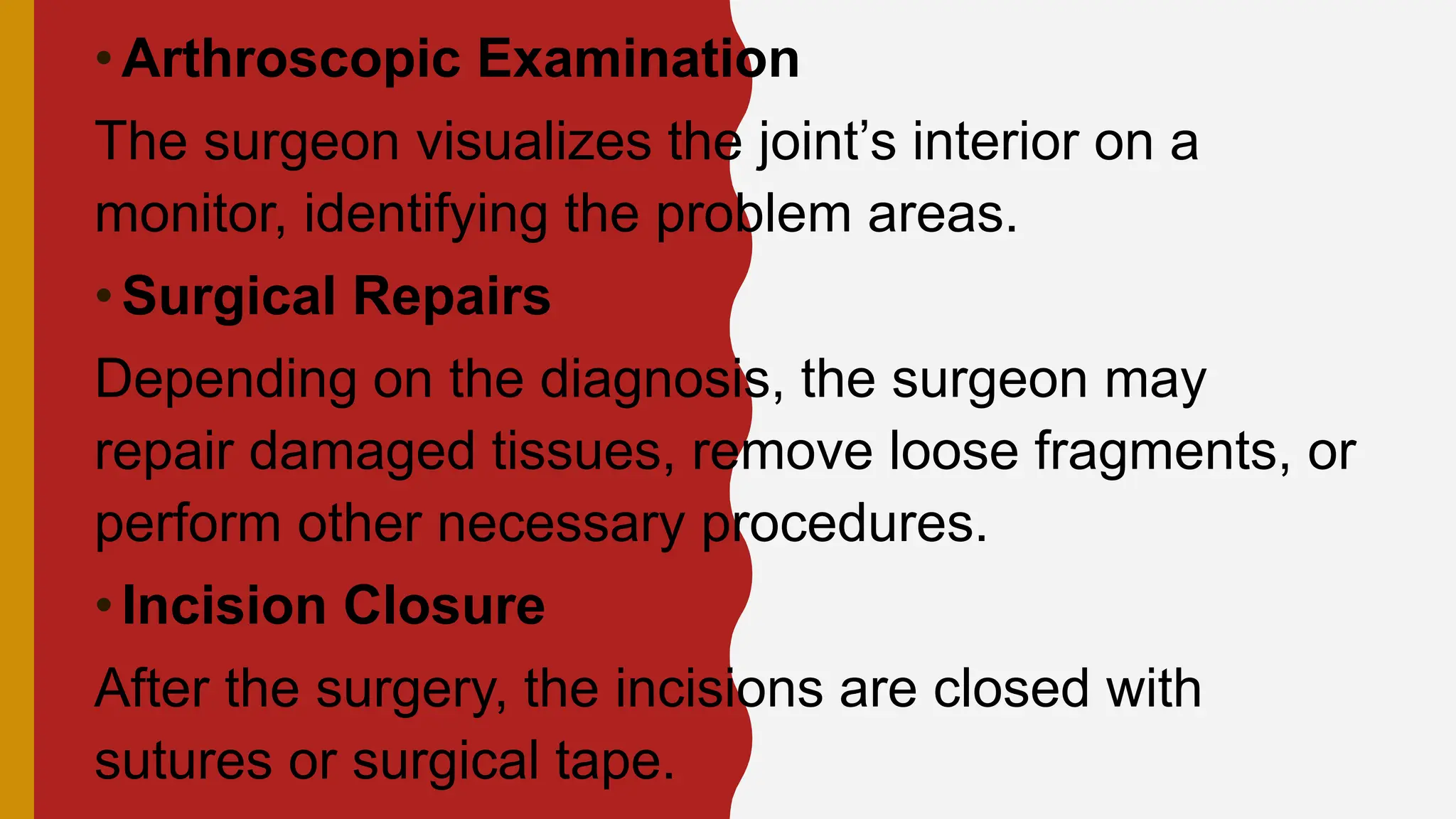 Arthroscopic Surgery in Indore : A Minimally Invasive Guide to Joint Health | PPTX