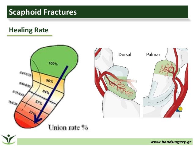 Arthroscopic treatment of scaphoid fractures & nonunions