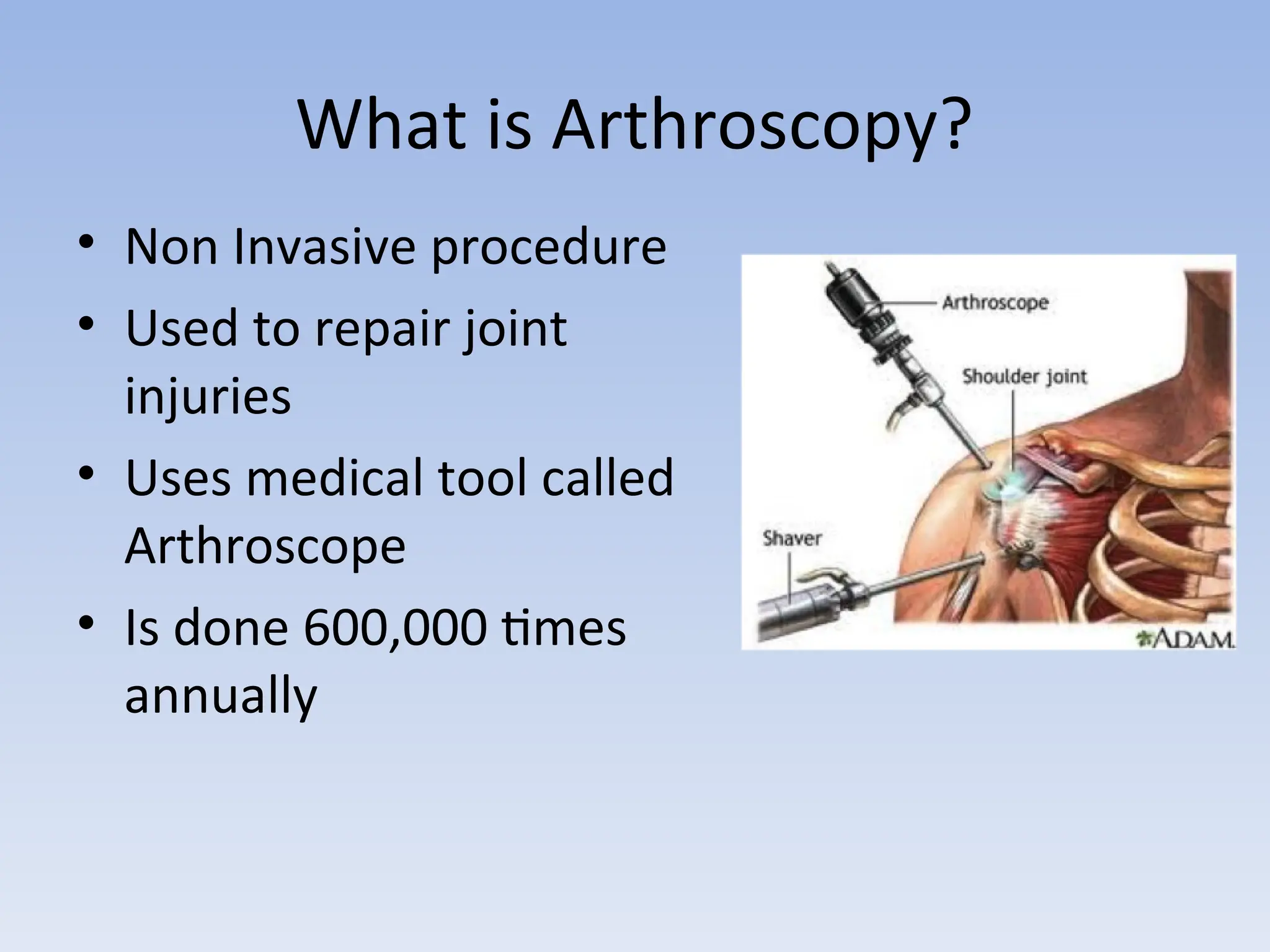 arthroscopy.ppt for physiotherapy studybook | PPT