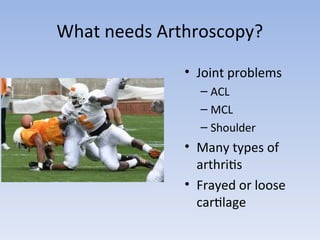arthroscopy.ppt for physiotherapy studybook | PPT