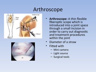 arthroscopy.ppt for physiotherapy studybook | PPT