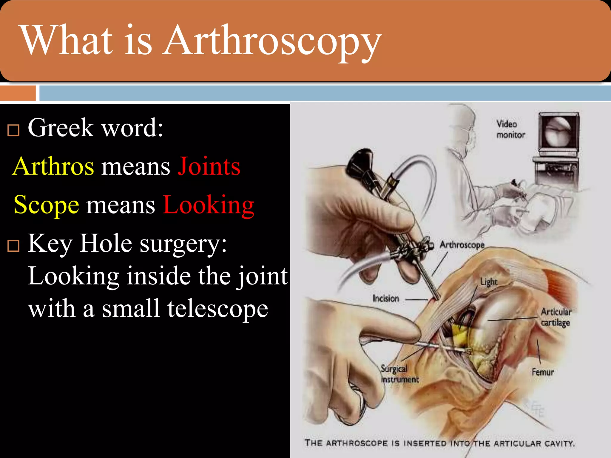 Arthroscopy key hole surgery | PPTX