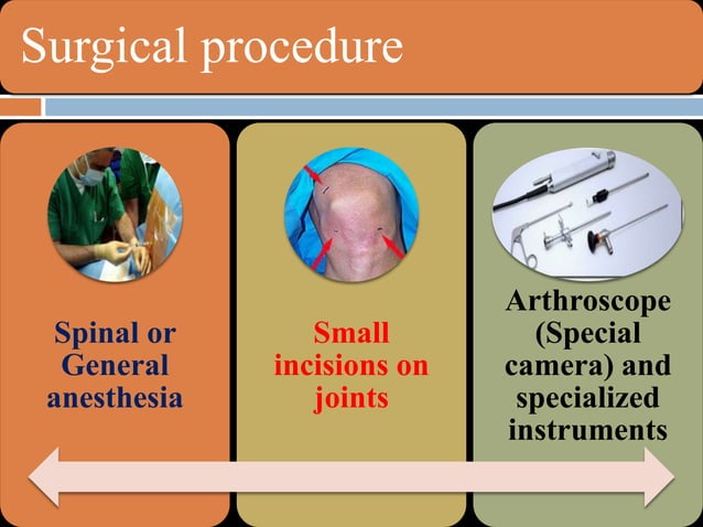 Arthroscopy key hole surgery | PPTX