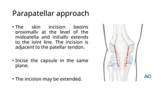 How to perform the paediatric arthrotomy knee.pptx