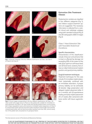 A Clinical Classification System for the Treatment of Postextraction ...