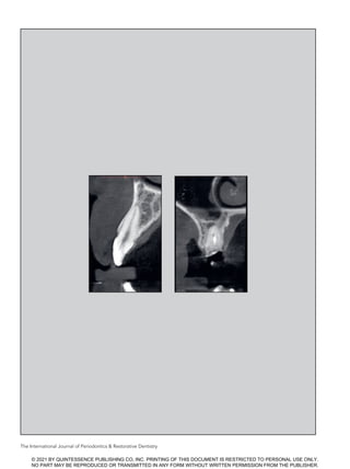 A Clinical Classification System for the Treatment of Postextraction ...