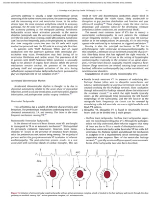 Article about arrhythmias | PDF