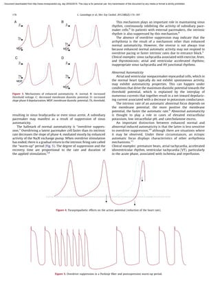 Article about arrhythmias | PDF