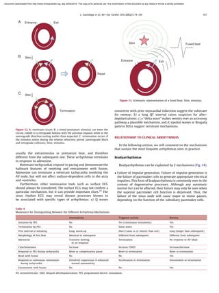 Article about arrhythmias | PDF