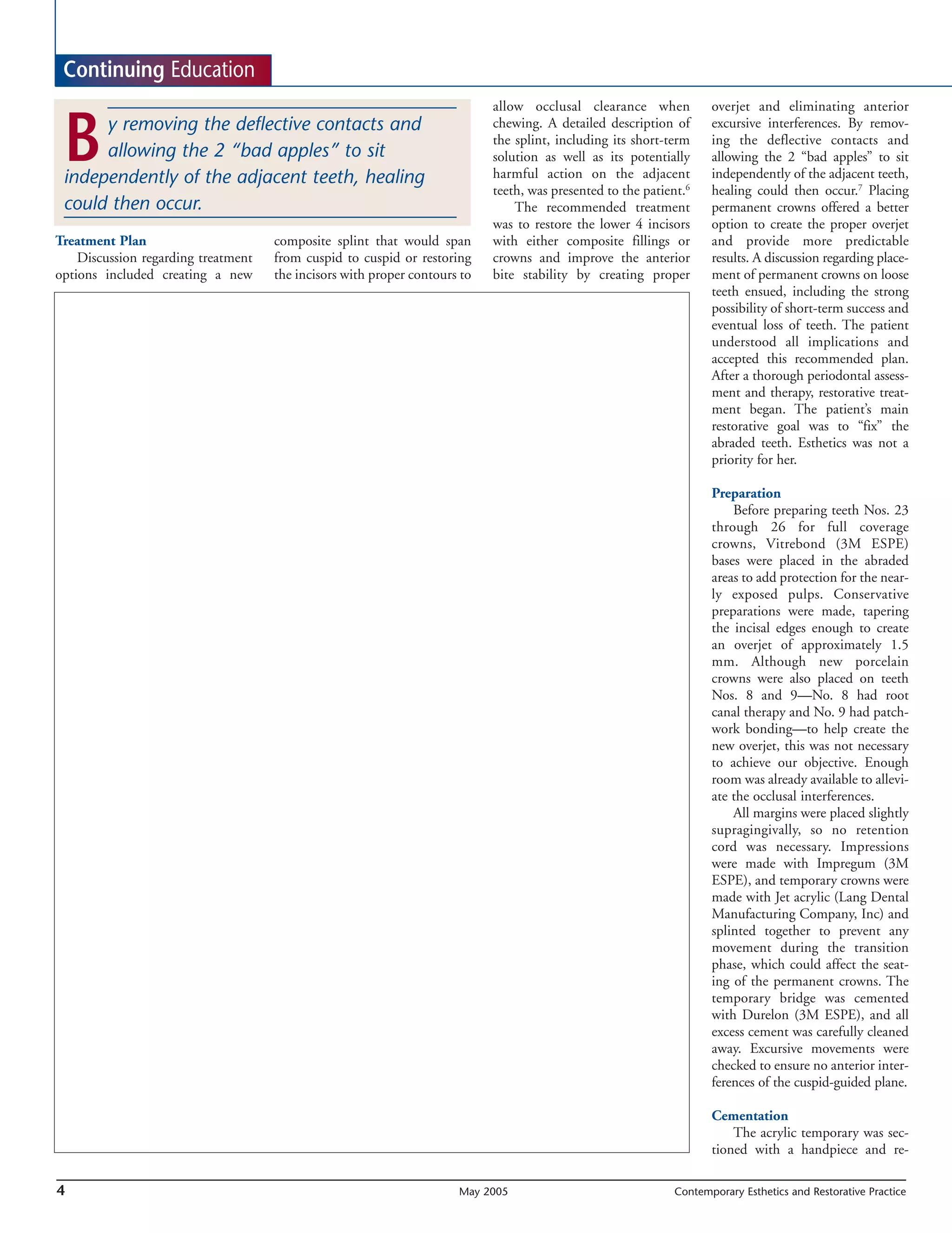 Article clinical splinting | PDF