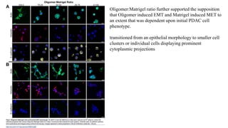 3D collagen fibrillar microstructure guides pancreatic cancer cell ...