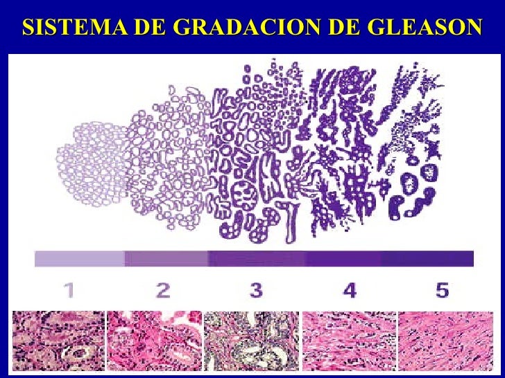 Articulación curricular prostata