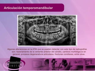 Articulación temporomandibular | PPTX