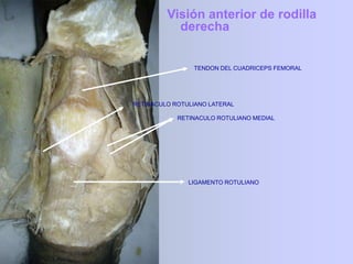 Articulacion d rodilla | PPTX