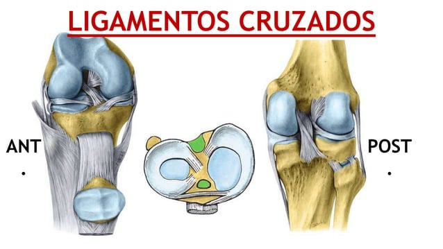 ARTICULACION DE LA RODILLA. SUPERFICIES ARTICULARES, LIGAMENTOS ...
