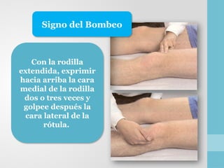 ARTICULACION DE LA RODILLA ANATOMIA.pptx