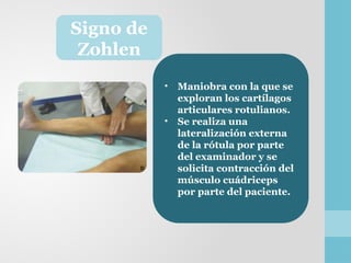 ARTICULACION DE LA RODILLA ANATOMIA.pptx