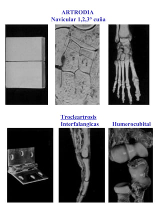 Articulaciones | PPT