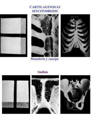 Articulaciones | PPT