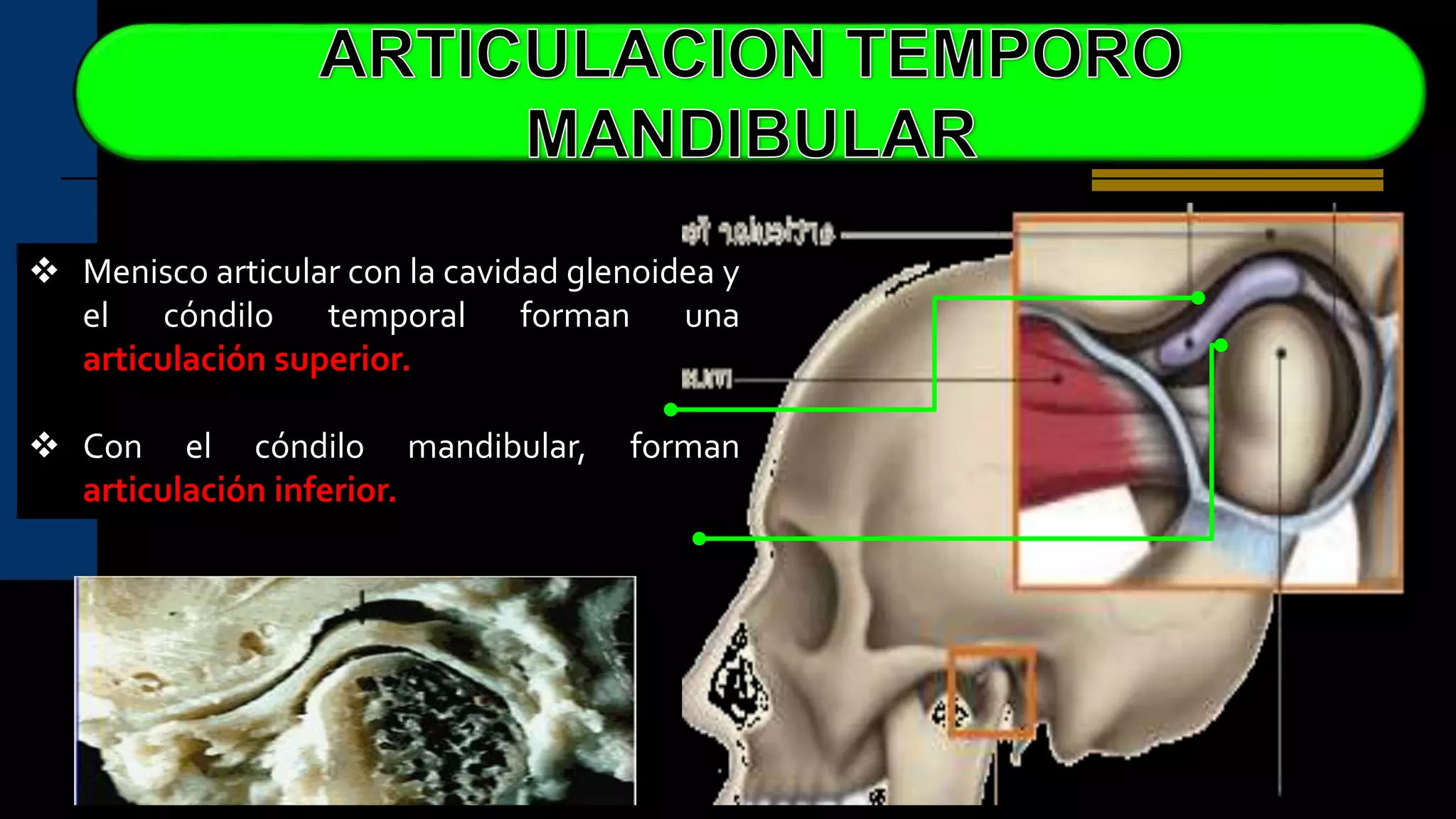 Articulacion Temporo mandibular | PPT