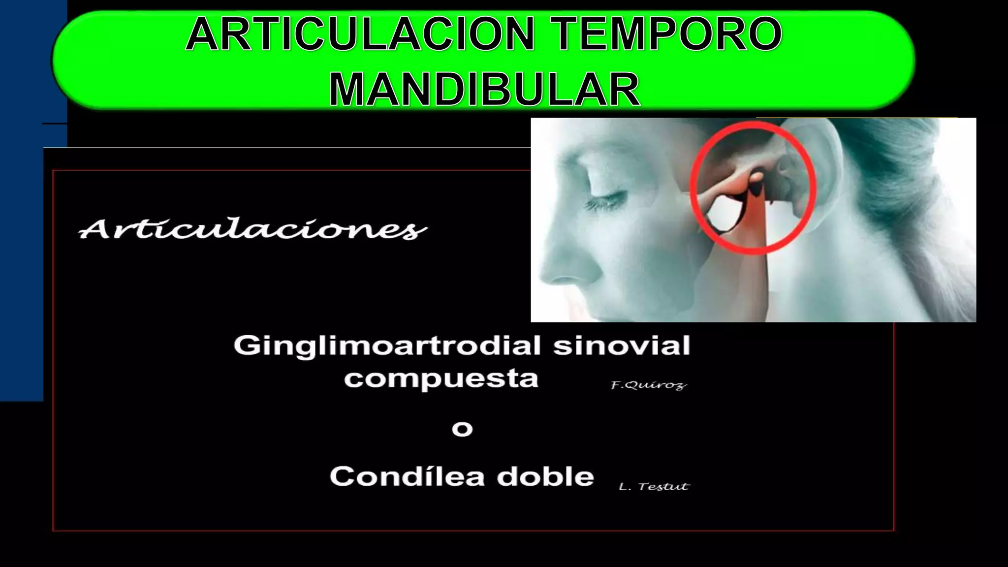 Articulacion Temporo mandibular | PPT