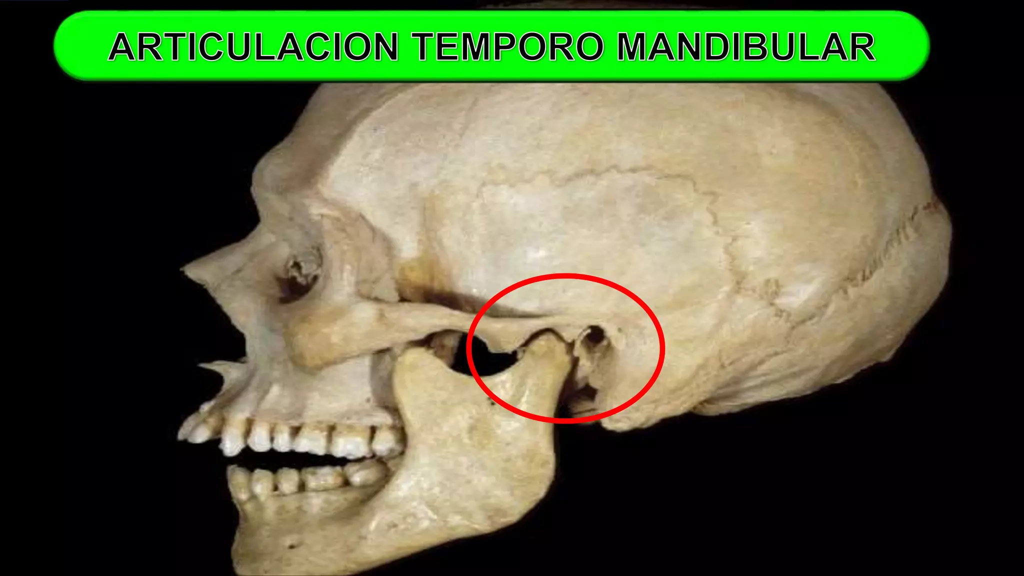 Articulacion Temporo mandibular | PPT