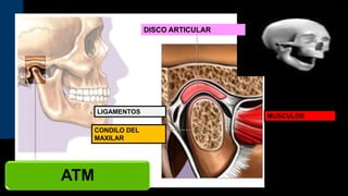Articulacion Temporo mandibular | PPTX