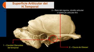 Articulacion Temporo mandibular | PPTX